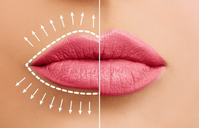 Tuto : comment repulper ses lèvres grâce au maquillage - Maquillage.com